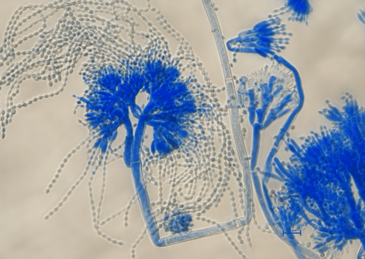 Building with Fungus: the ARCHI-SKIN Project - RD Magazine